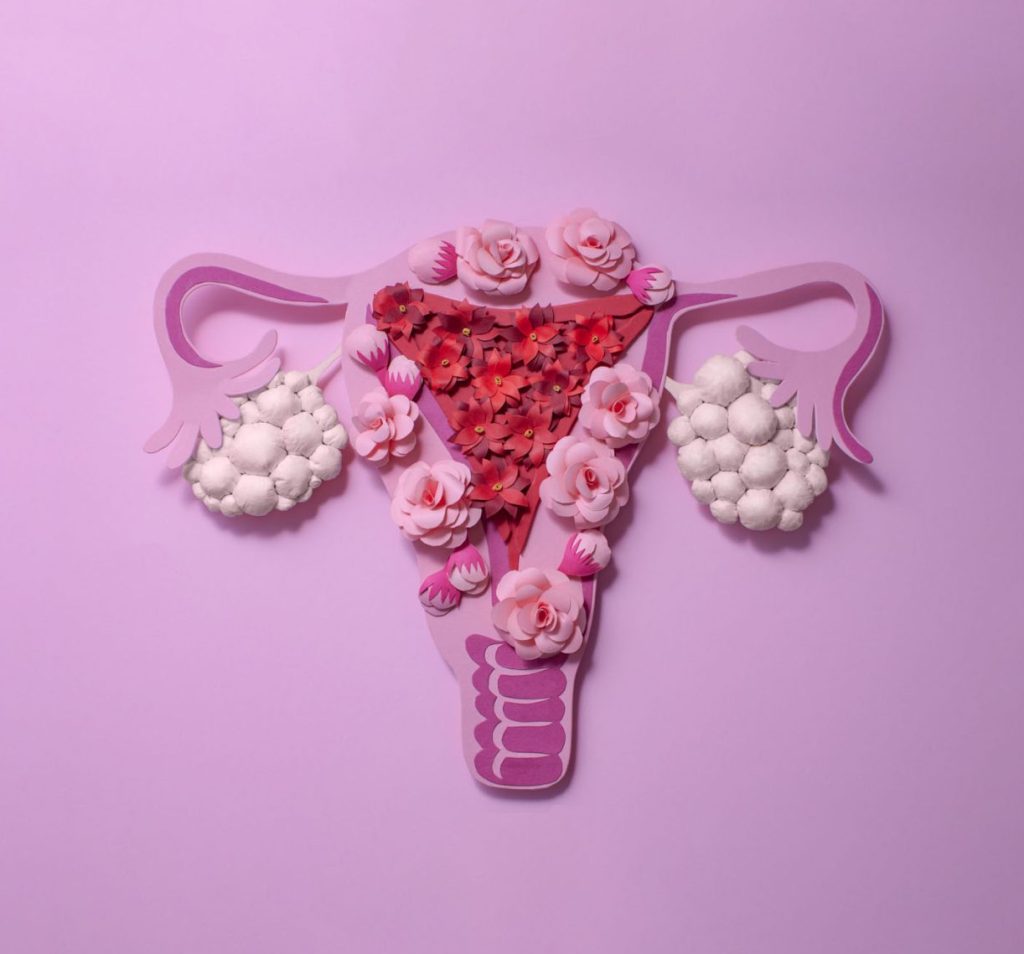 Concept polycystic ovary syndrome, PCOS. Women reproductive system ...